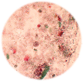 e-hartmanni-web – Parasitology world