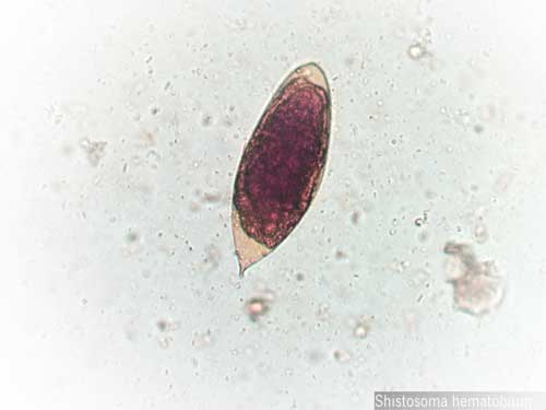 s.-haematobium-web – Parasitology world