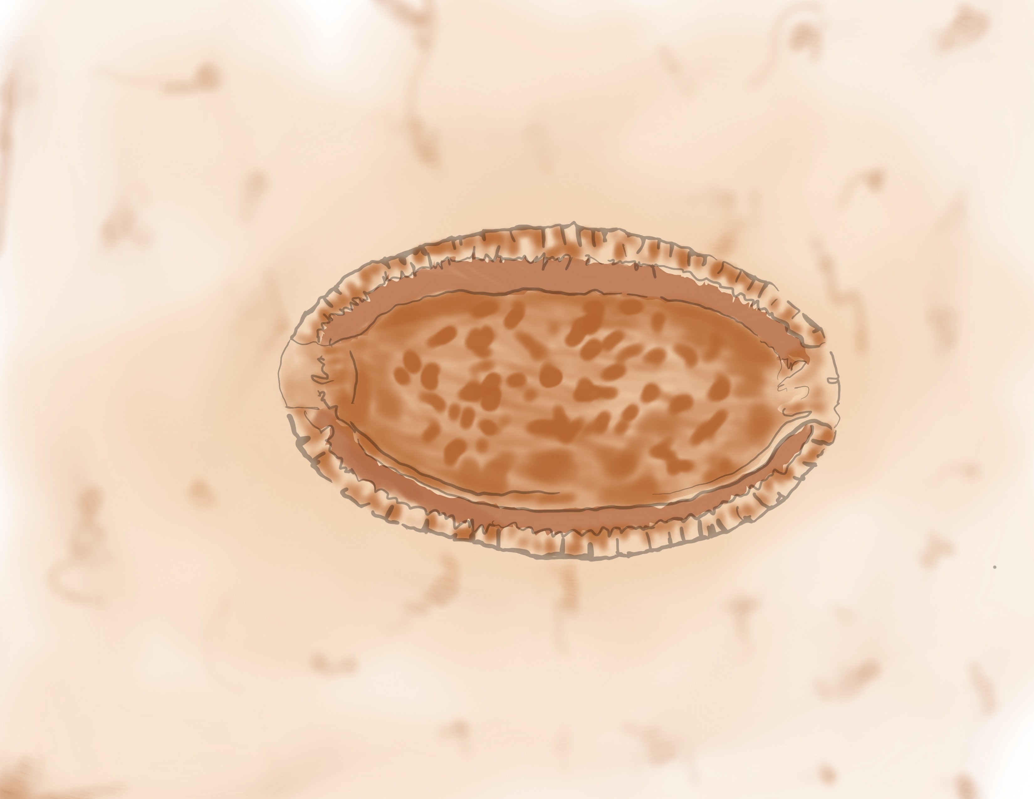 Capillaria philippinensis / Capillaria hepatica – Parasitology world
