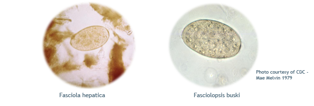 Fasciola hepatica – Parasitology world